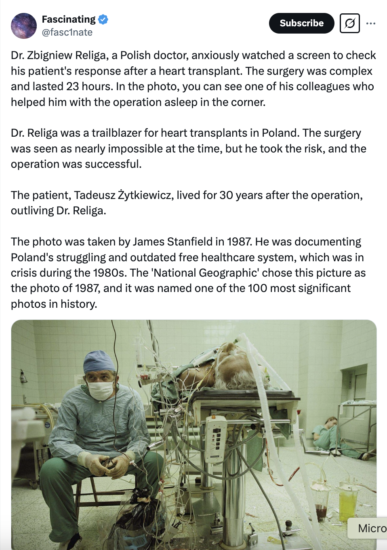 Prof. Zbigniew Religa – The first Polish doctor to perform successful ...
